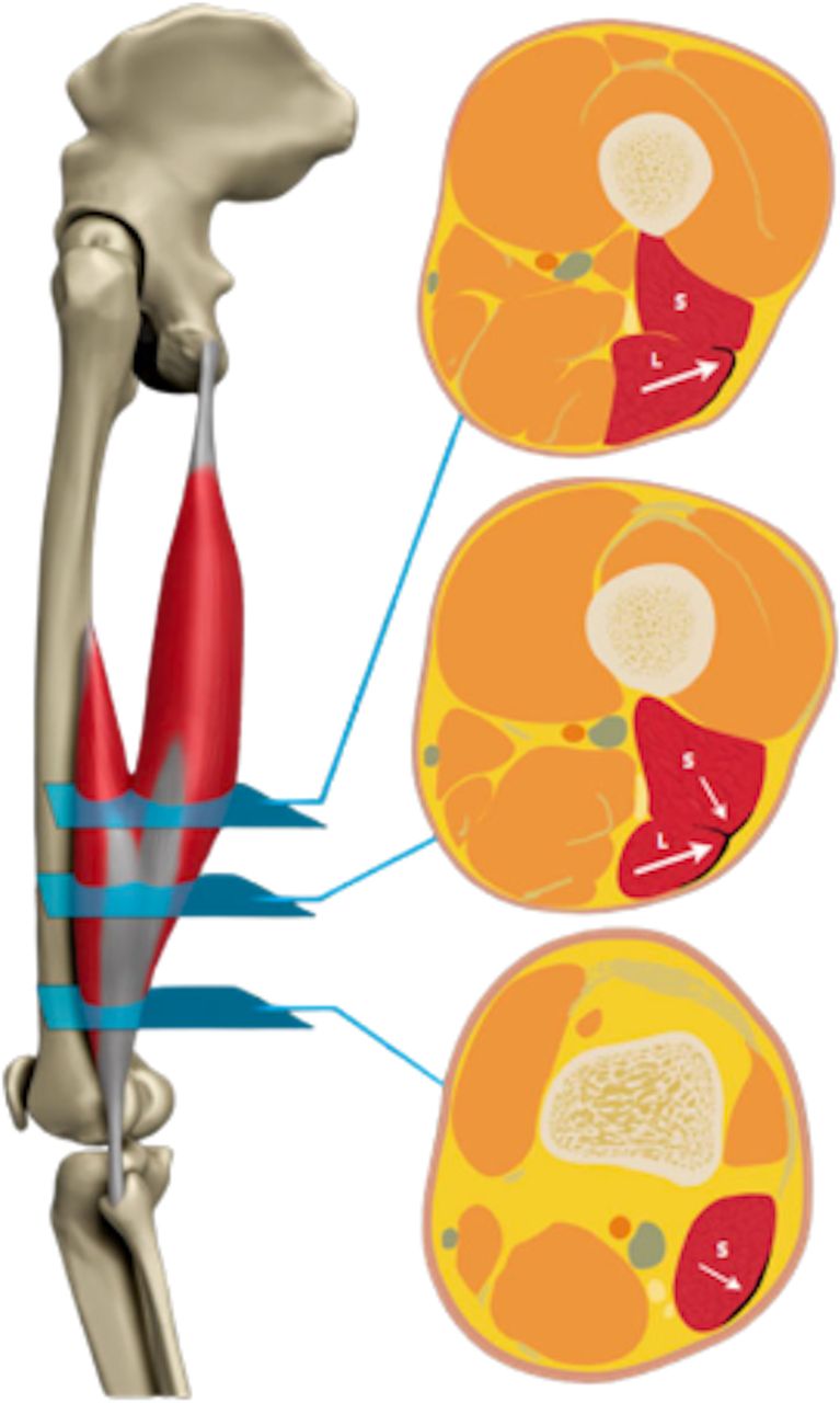 Biceps Femoris Muscle Injury Recovery Time